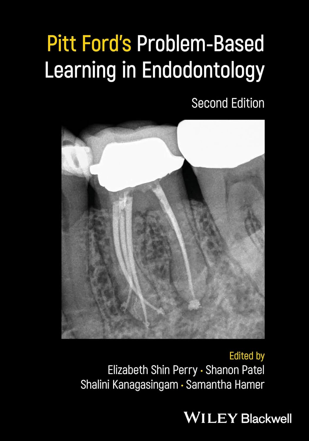 Pitt Ford's Problem-Based Learning in Endodontology: 9781119565970 ...