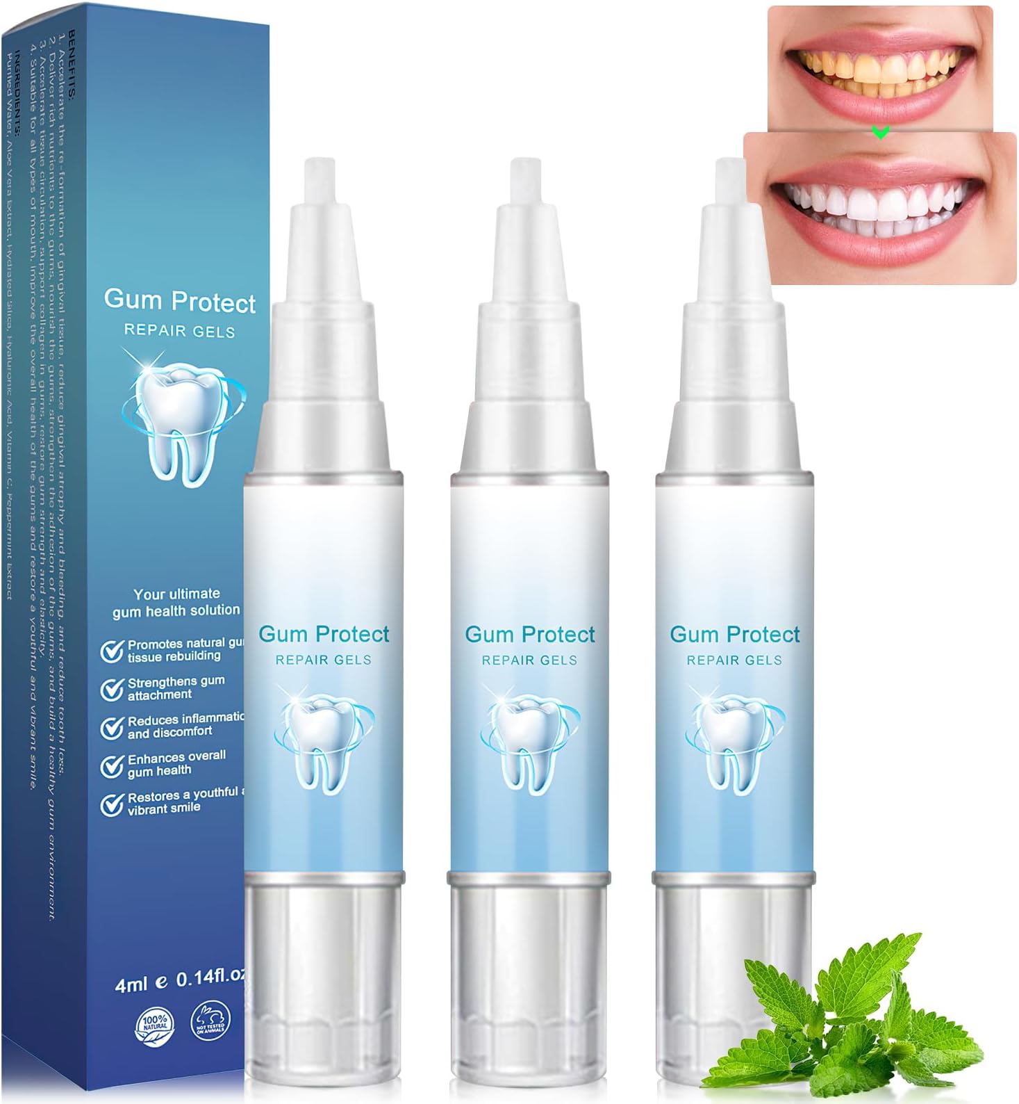 Amazon.com: Neslemy Gum Gel,Neslemy Gum Shield Therapy Gel,Teeth ...