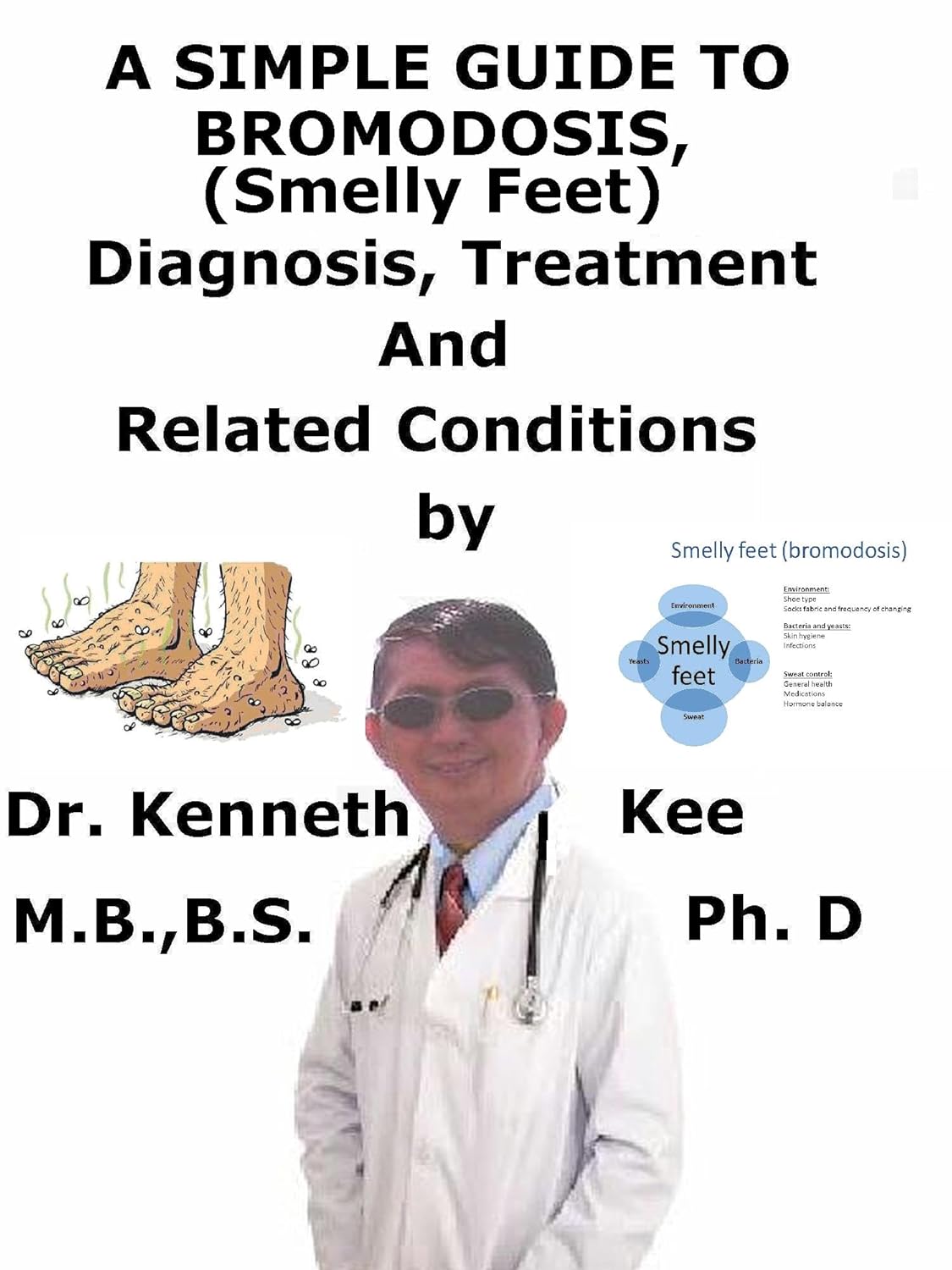 A Simple Guide To Bromodosis (Smelly Feet), Diagnosis, Treatment And ...