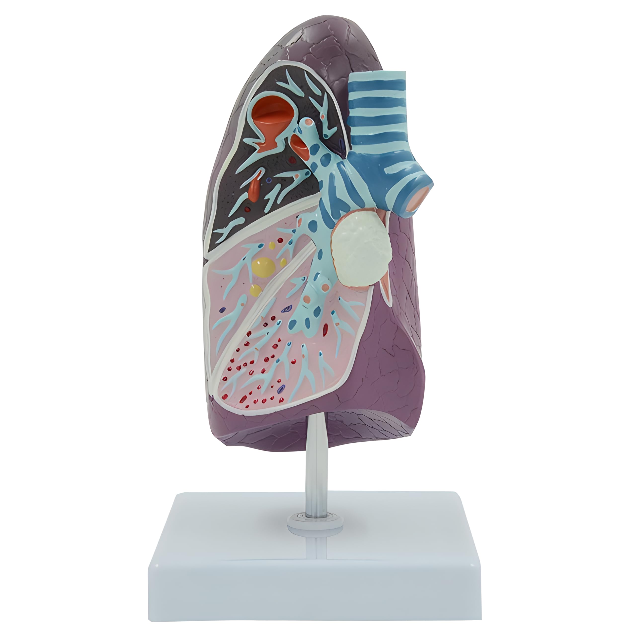 Amazon.com: YANHAO Lung Cancer Model Pathology Lung Model 3D Human Lung ...