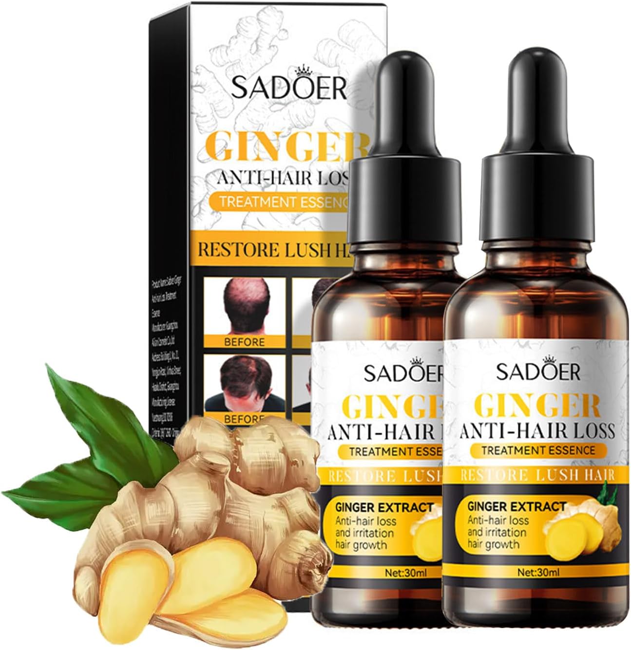 Amazon.com : "MQSHUHENMY Shouga Kingu Hair Growth Oil, Ginger Oil, 50ml ...