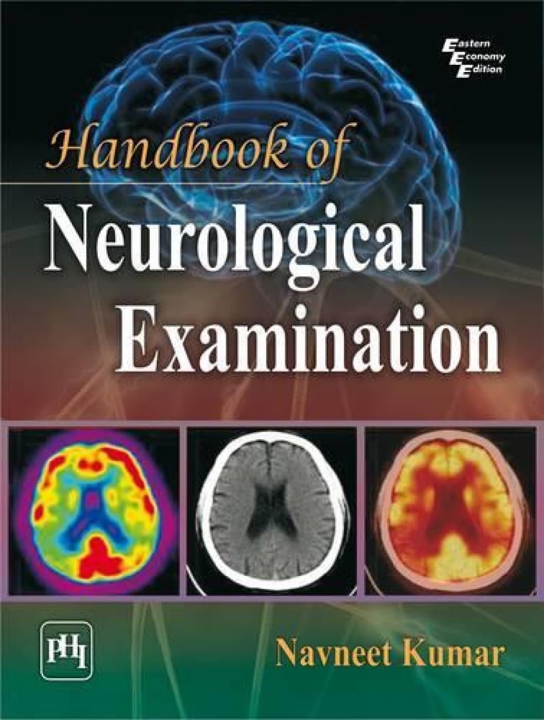 Handbook of Neurological Examination: Navneet Kumar: 9788120342767 ...