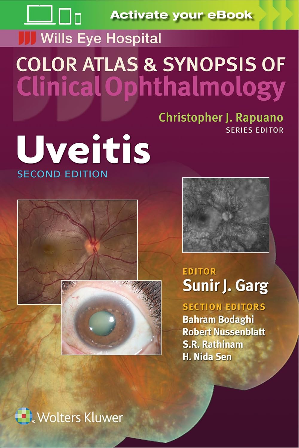 Uveitis (Color Atlas and Synopsis of Clinical Ophthalmology ...