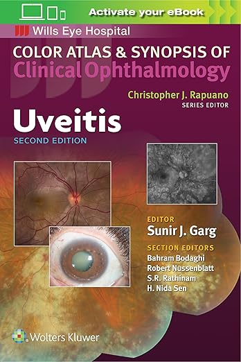 Uveitis (Color Atlas and Synopsis of Clinical Ophthalmology ...