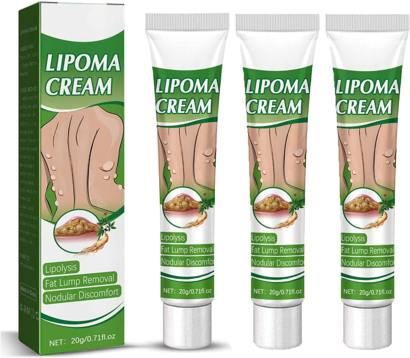 LipomaCure Soothing Ointment, LipoPRO Instant Lipoma Removal Cream ...