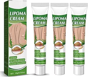 LipomaCure Soothing Ointment, LipoPRO Instant Lipoma Removal Cream ...