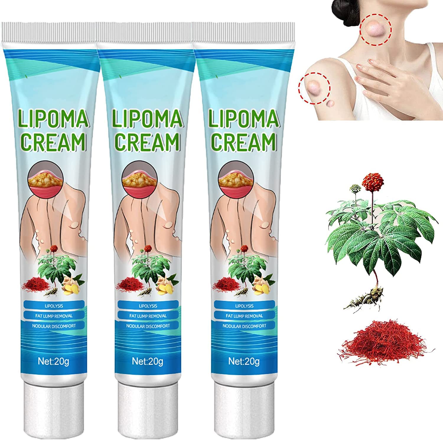 South Moon Lumpfree Lipoma Removal Cream Lumpfree Lipoma Removal Cream ...