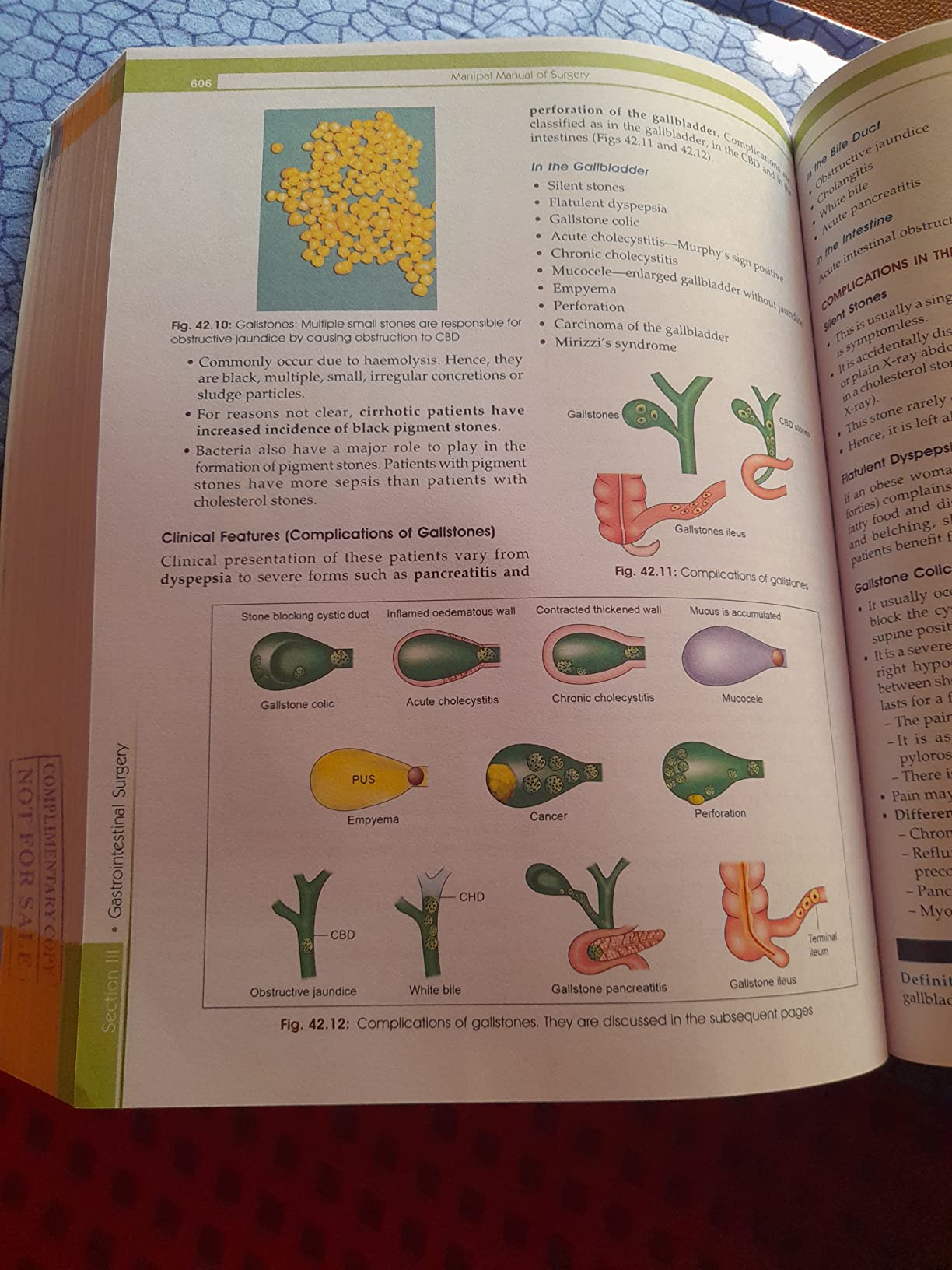 Buy MANIPAL MANUAL OF SURGERY 6ED 2 VOL SET (PB 2023) (CBME EDITION ...