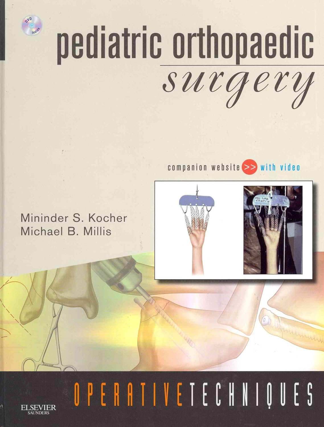 Operative Techniques: Pediatric Orthopaedic Surgery: 9781416049159 ...