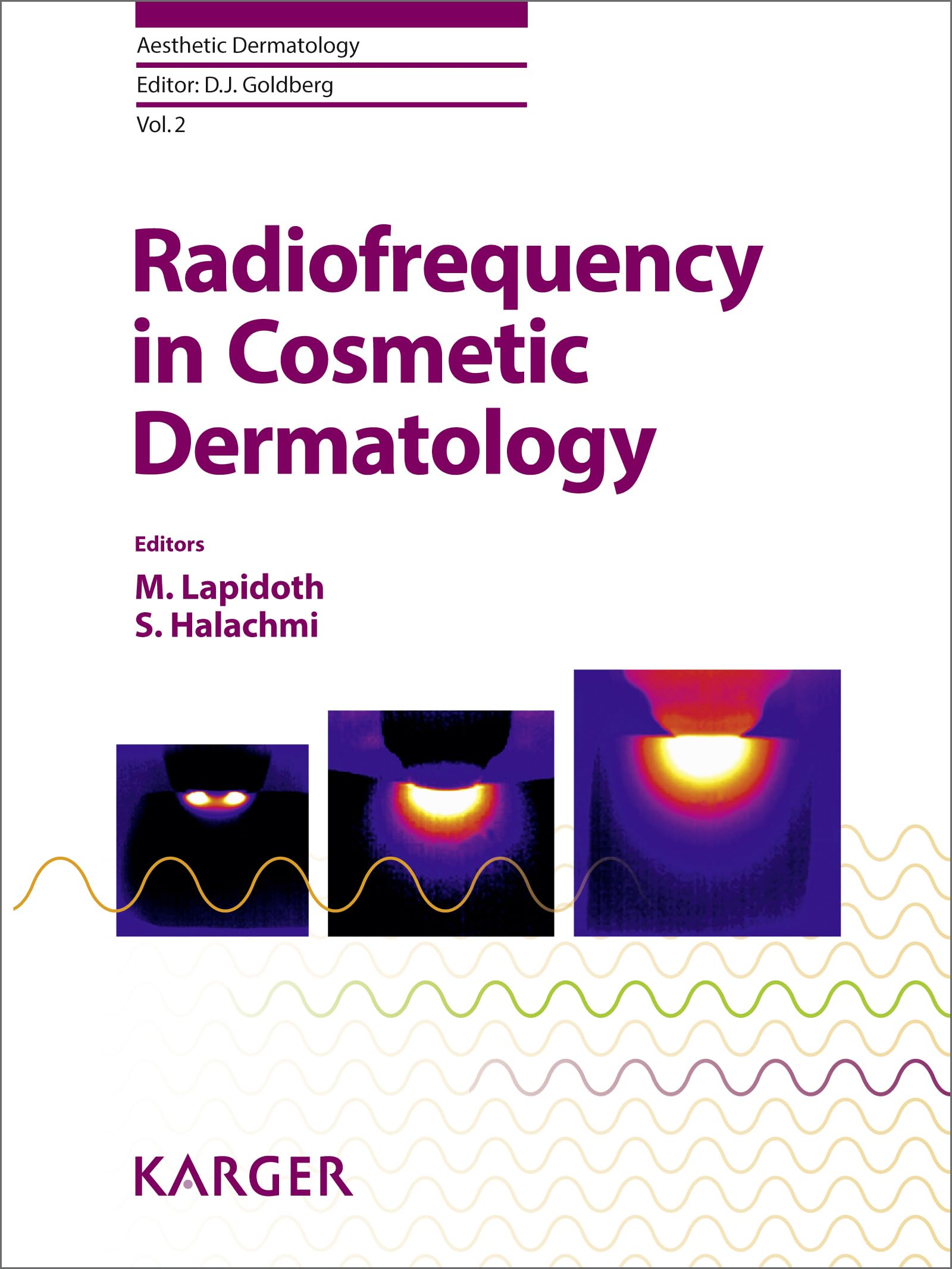 Radiofrequency in Cosmetic Dermatology (Aesthetic Dermatology ...