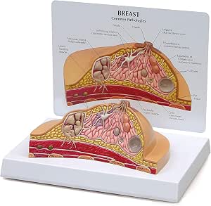 Breast Cross-Section Anatomical Model,Human Body Anatomy Replica of ...