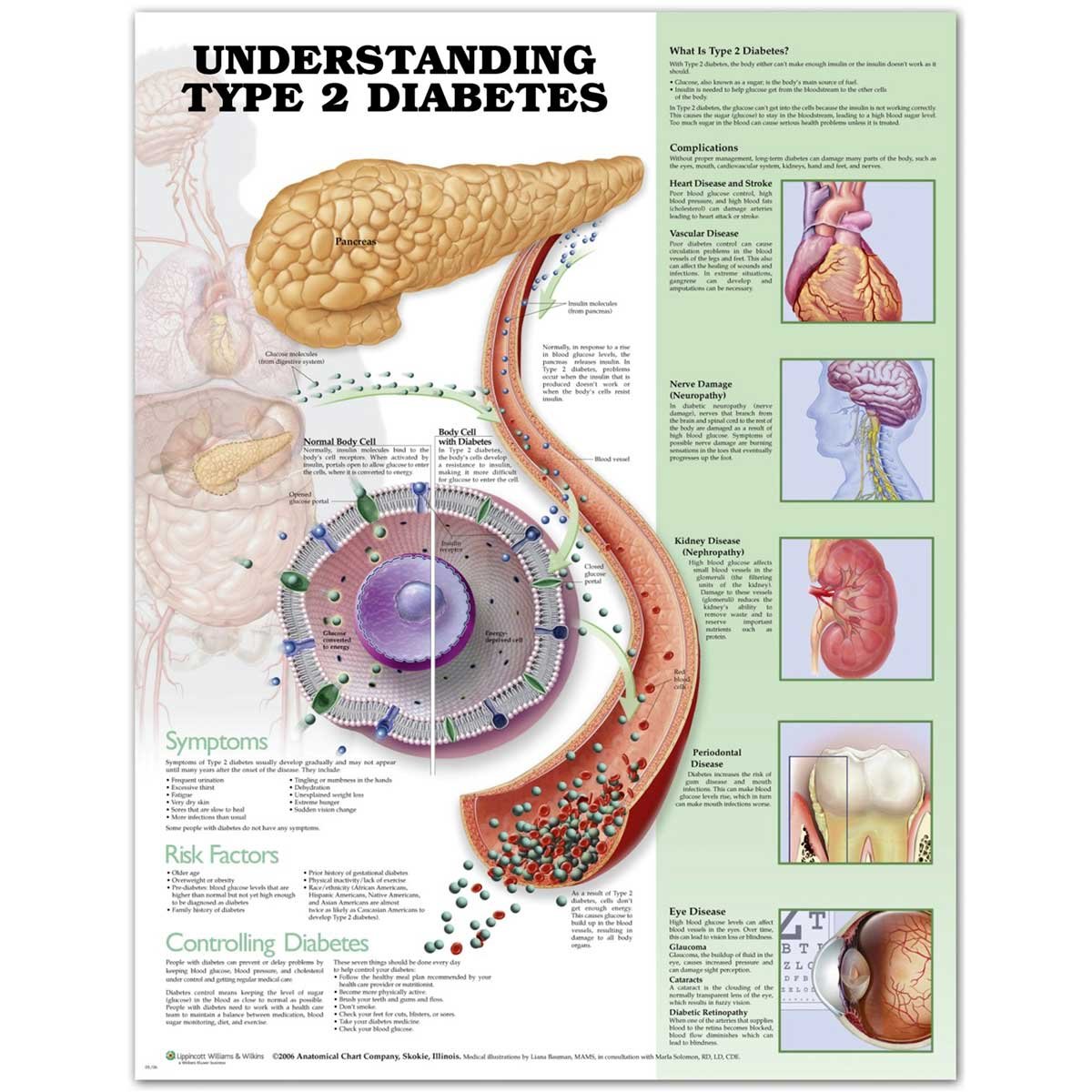 Understanding Type 2 Diabetes Anatomical Chart : Unger, Jeff: Amazon.co ...
