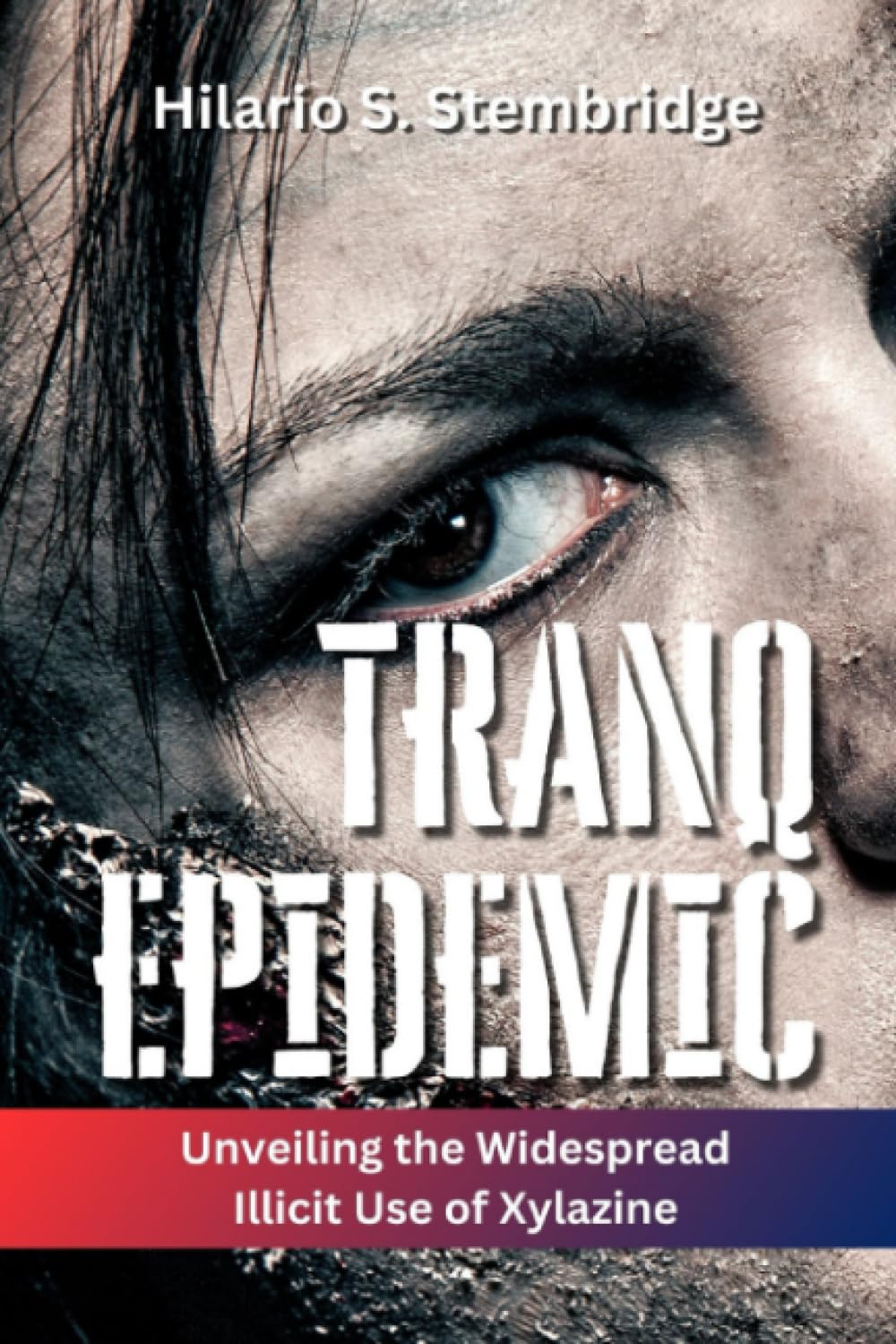 Tranq Epidemic: Unveiling the Widespread Illicit Use of Xylazine ...