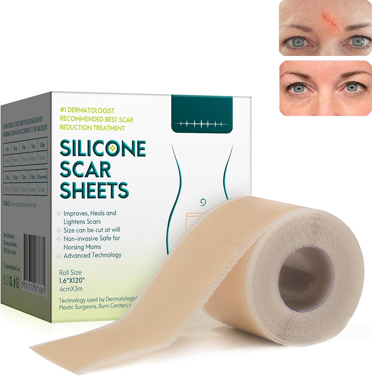 Silicone Scar Sheets (1.6”x 120”, 3M), Silicone Scar Tape, Scar Strips ...