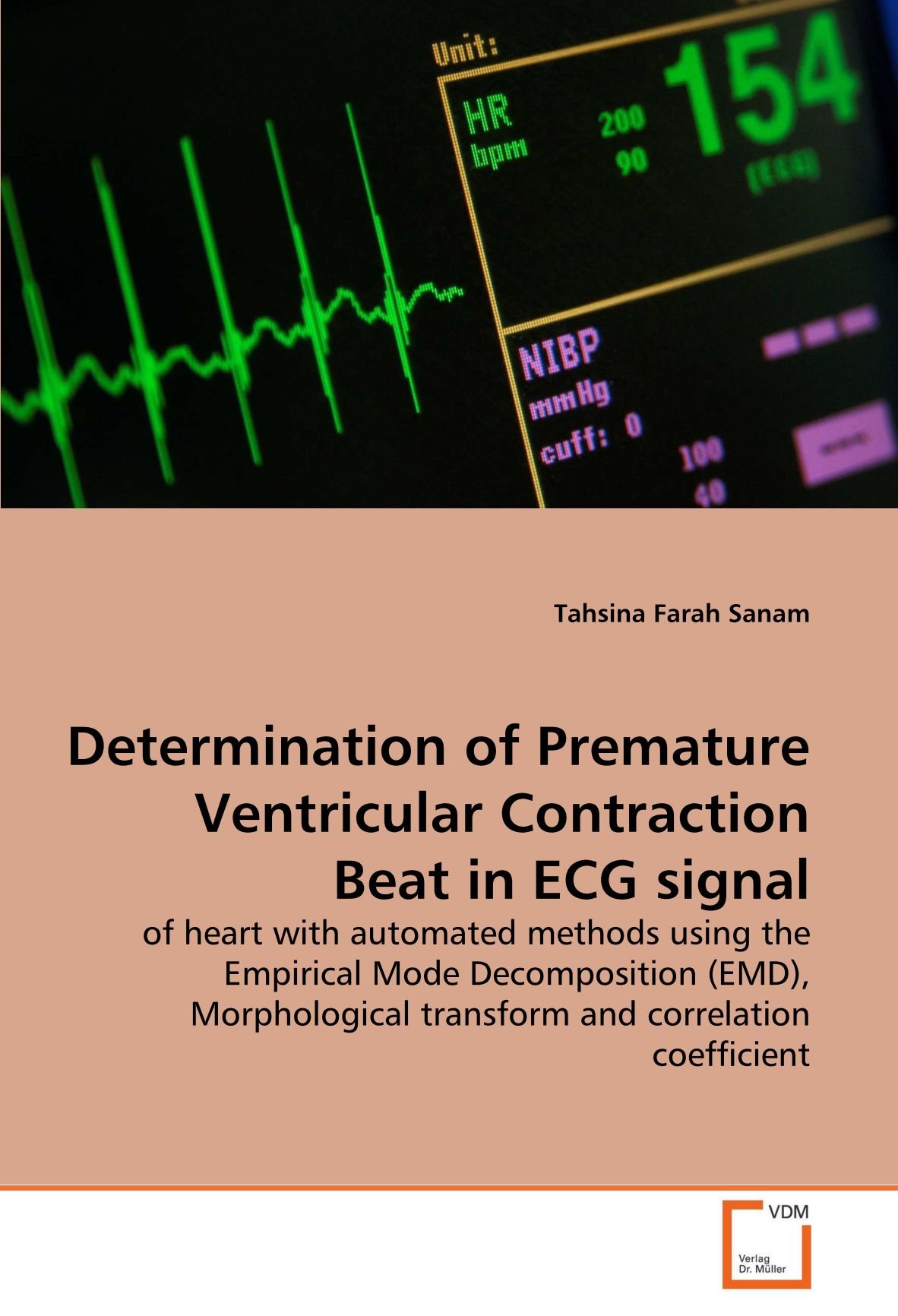 Buy Determination of Premature Ventricular Contraction Beat in ECG ...