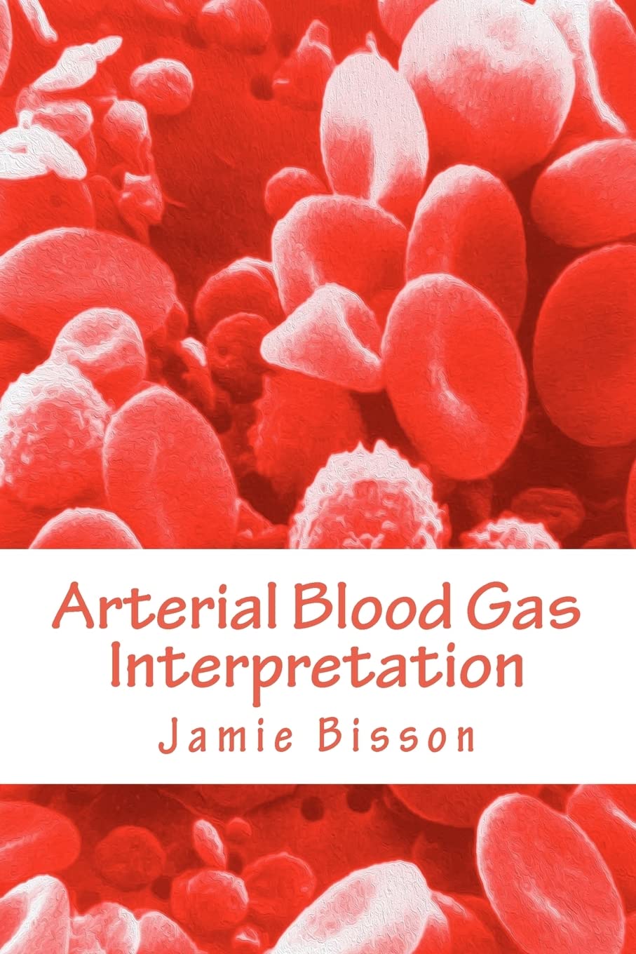 Arterial Blood Gas Interpretation: Bisson, Mr Jamie, Bisson, Mr Jamie ...