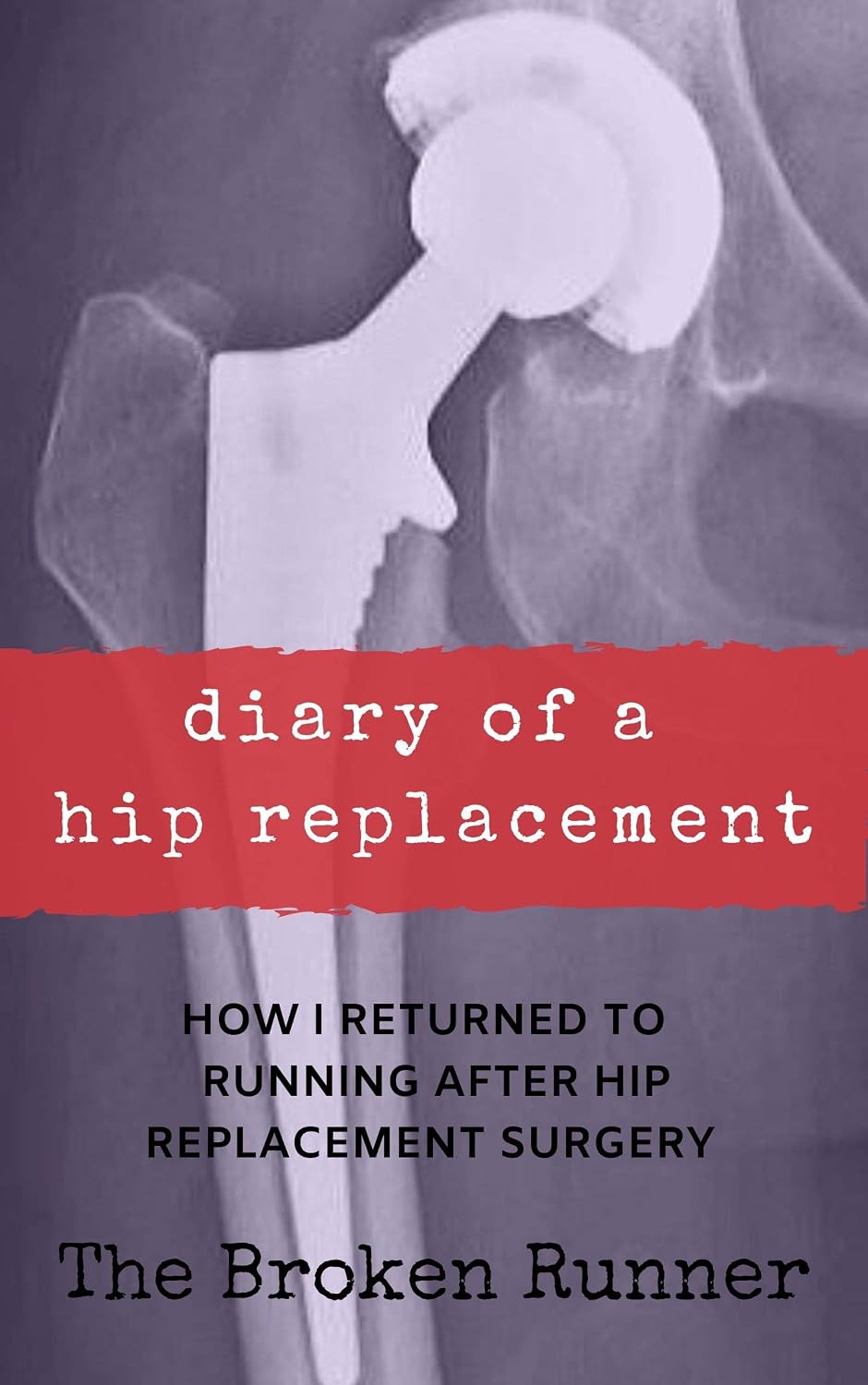 Amazon.com: Diary of a Hip Replacement: How I returned to running after ...