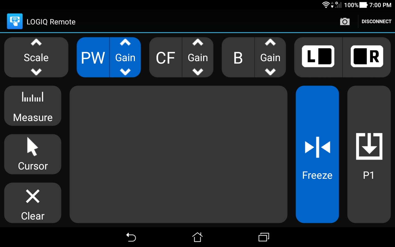 LOGIQ Remote - App on Amazon Appstore