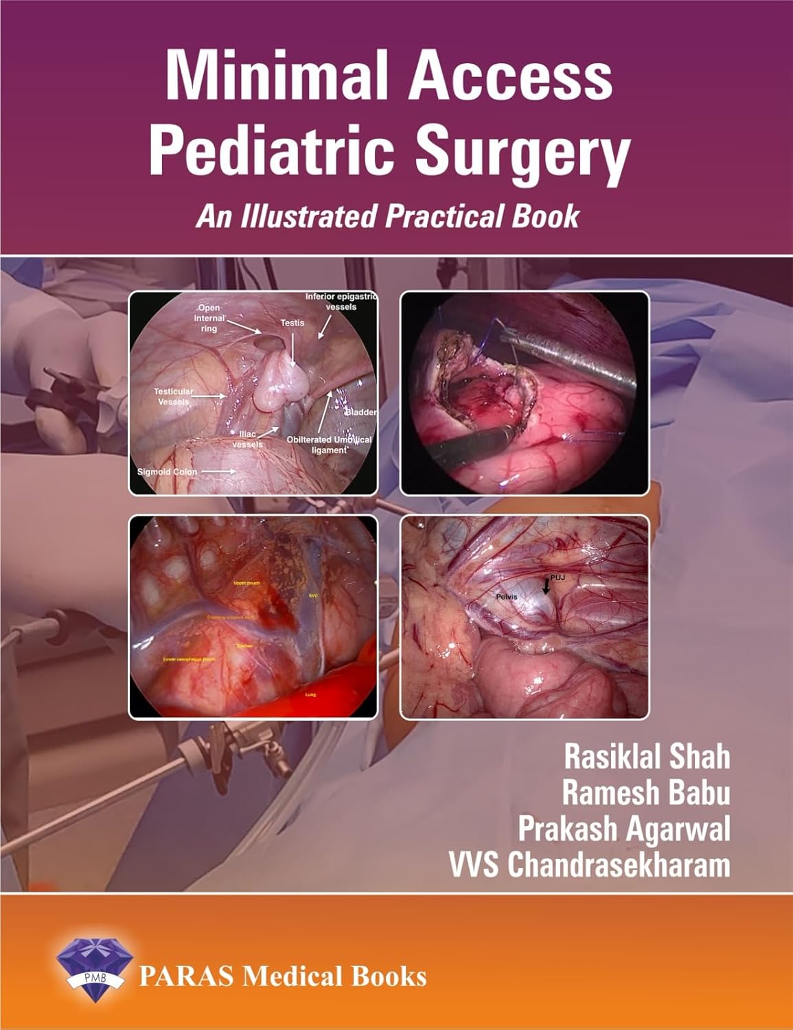 Buy Minimal Access Pediatric Surgery - An Illustrated Practical Book ...