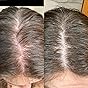 Amazon.com : hers Triple Threat Shampoo, Conditioner and Minoxidil Set ...