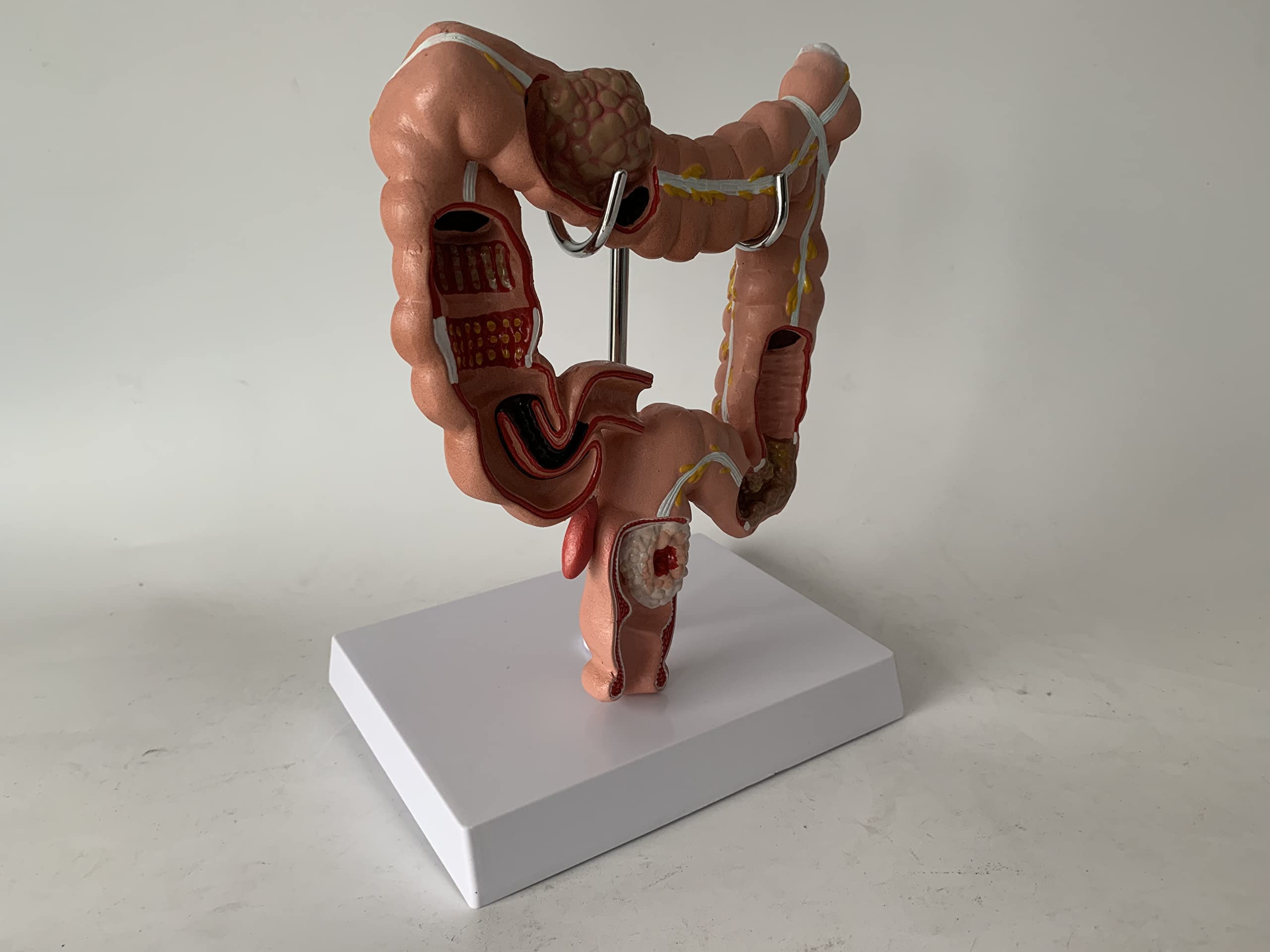 Buy Human Large Intestine Anatomical Model Colon Pathology Model - PVC ...