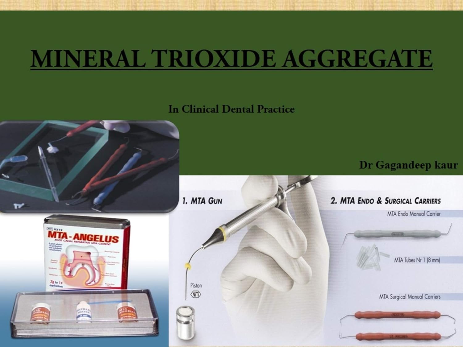 MINERAL TRIOXIDE AGGREGATE: In Clinical Dental Practice eBook : Kaur ...