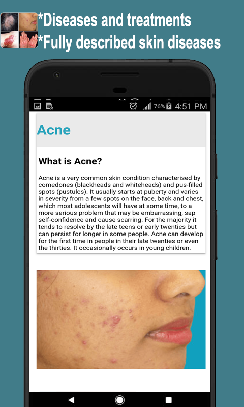 All Skin Diseases and Treatment A-Z - App on Amazon Appstore