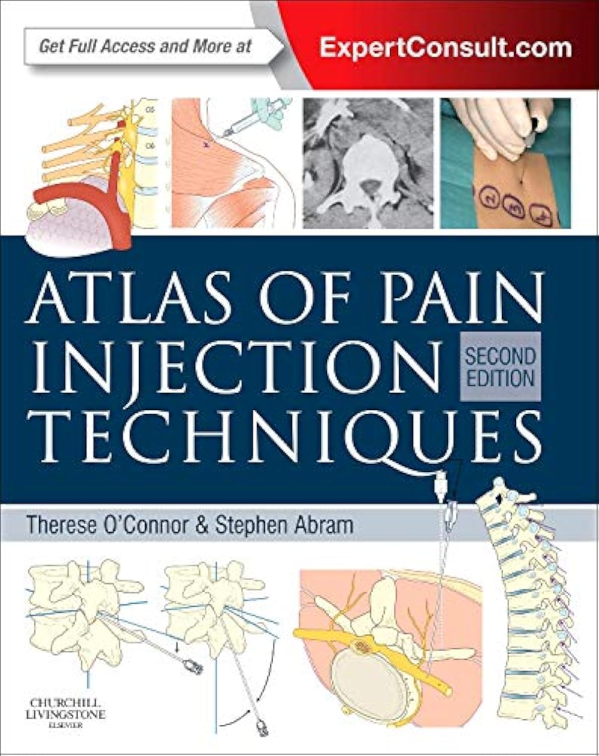 Atlas of Pain Injection Techniques: Expert Consult: Online and Print ...