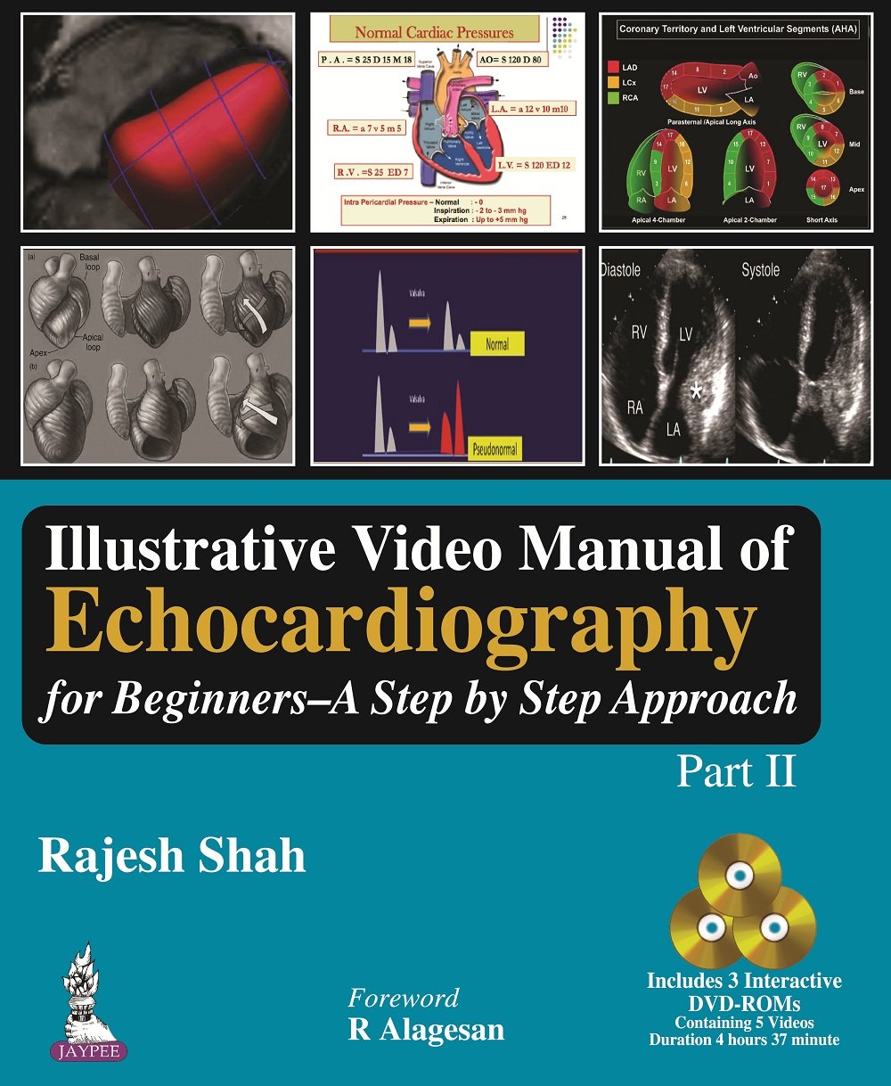 Illustrative Video Manual of Echocardiography for Beginners: A Step by ...