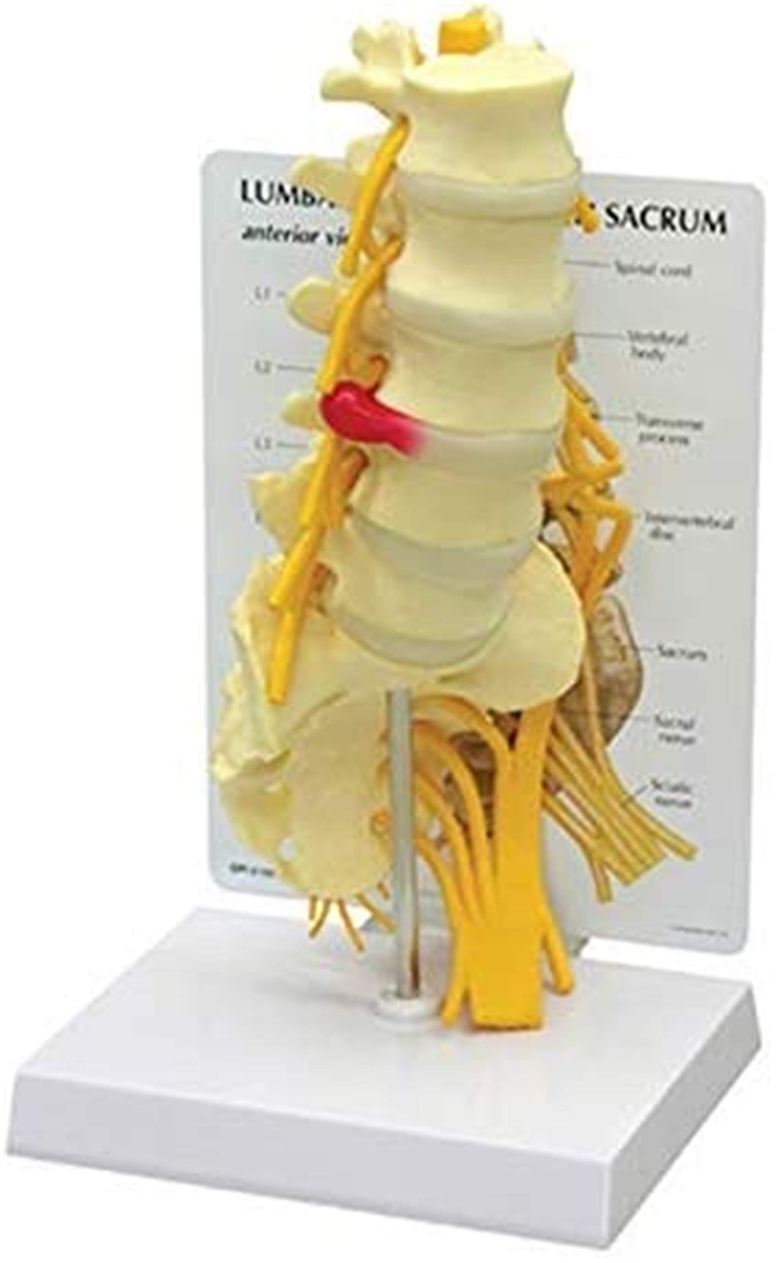 Buy ZAMAX Study Model Human Anatomy Lumbar Spine Model - Human Anatomy ...