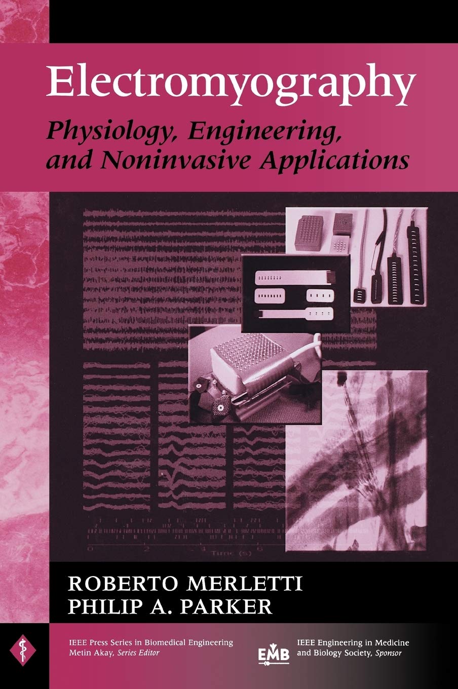 Electromyography: Physiology, Engineering, and Non-Invasive ...