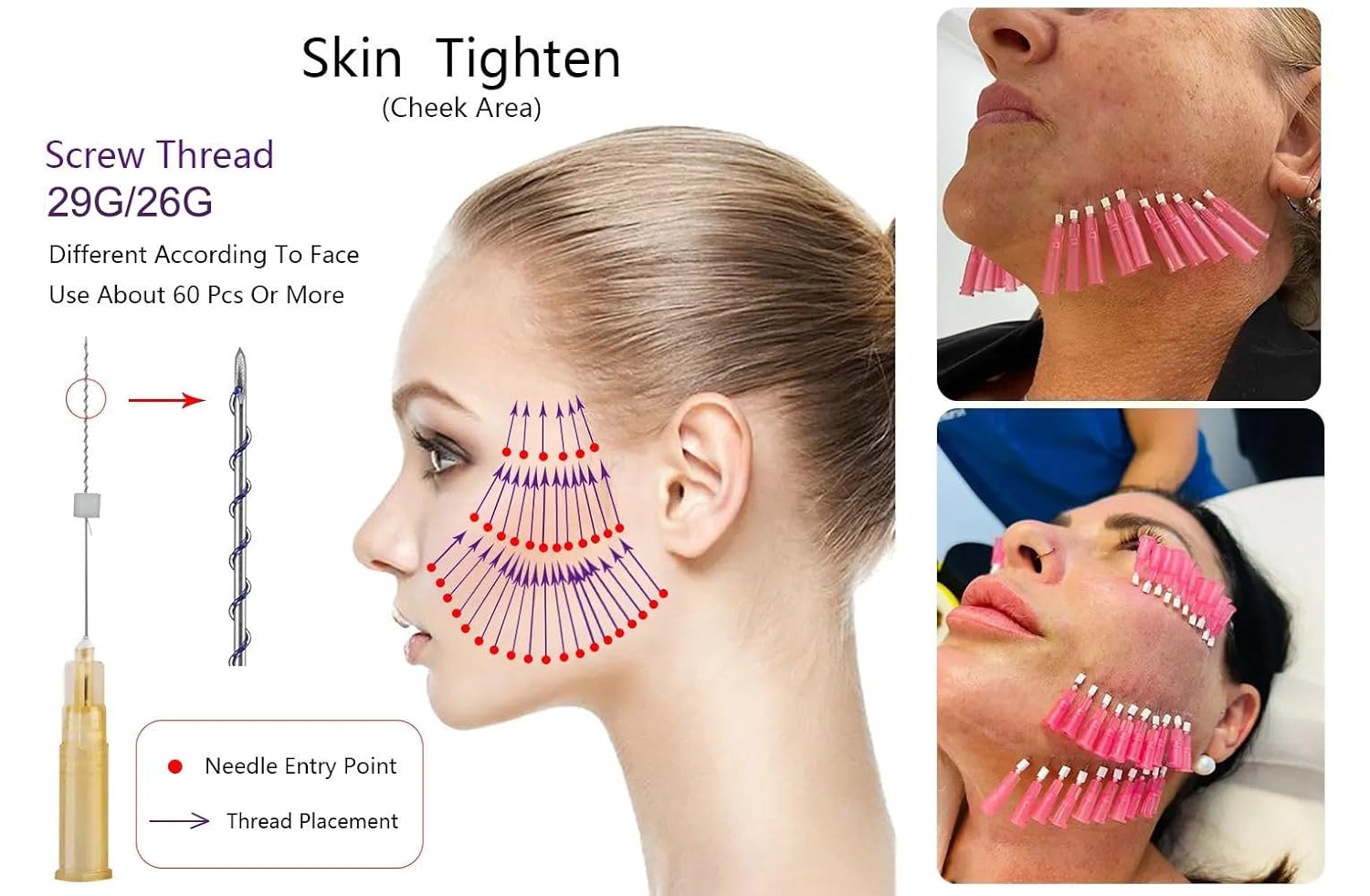 PDO Threads – Tipo de engranaje 3D mejorado para rostrocuerpo entero ...