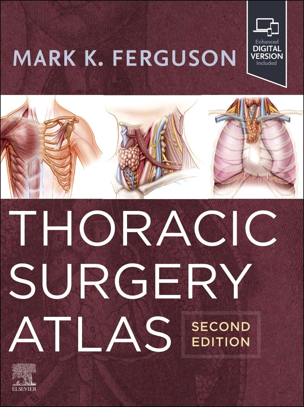 Thoracic Surgery Atlas: 9780323930222: Medicine & Health Science Books ...
