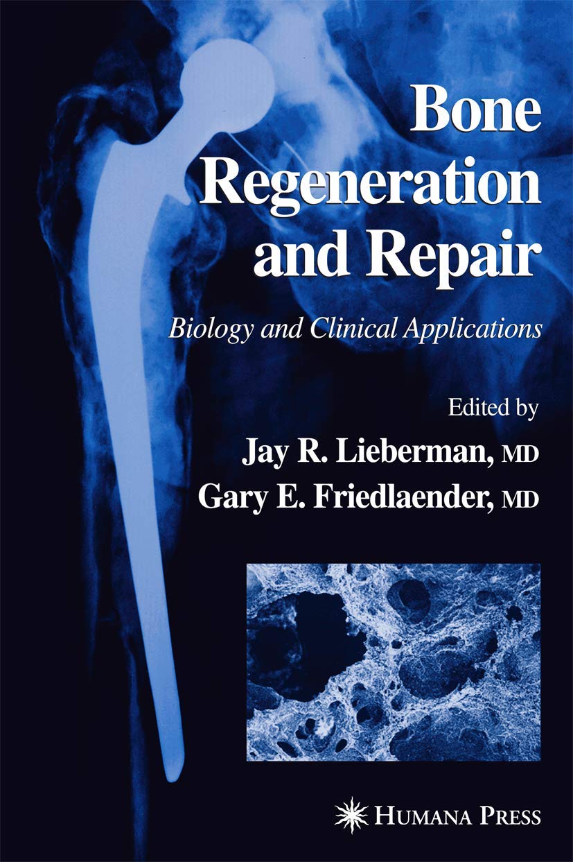 Bone Regeneration and Repair: Biology and Clinical Applications ...