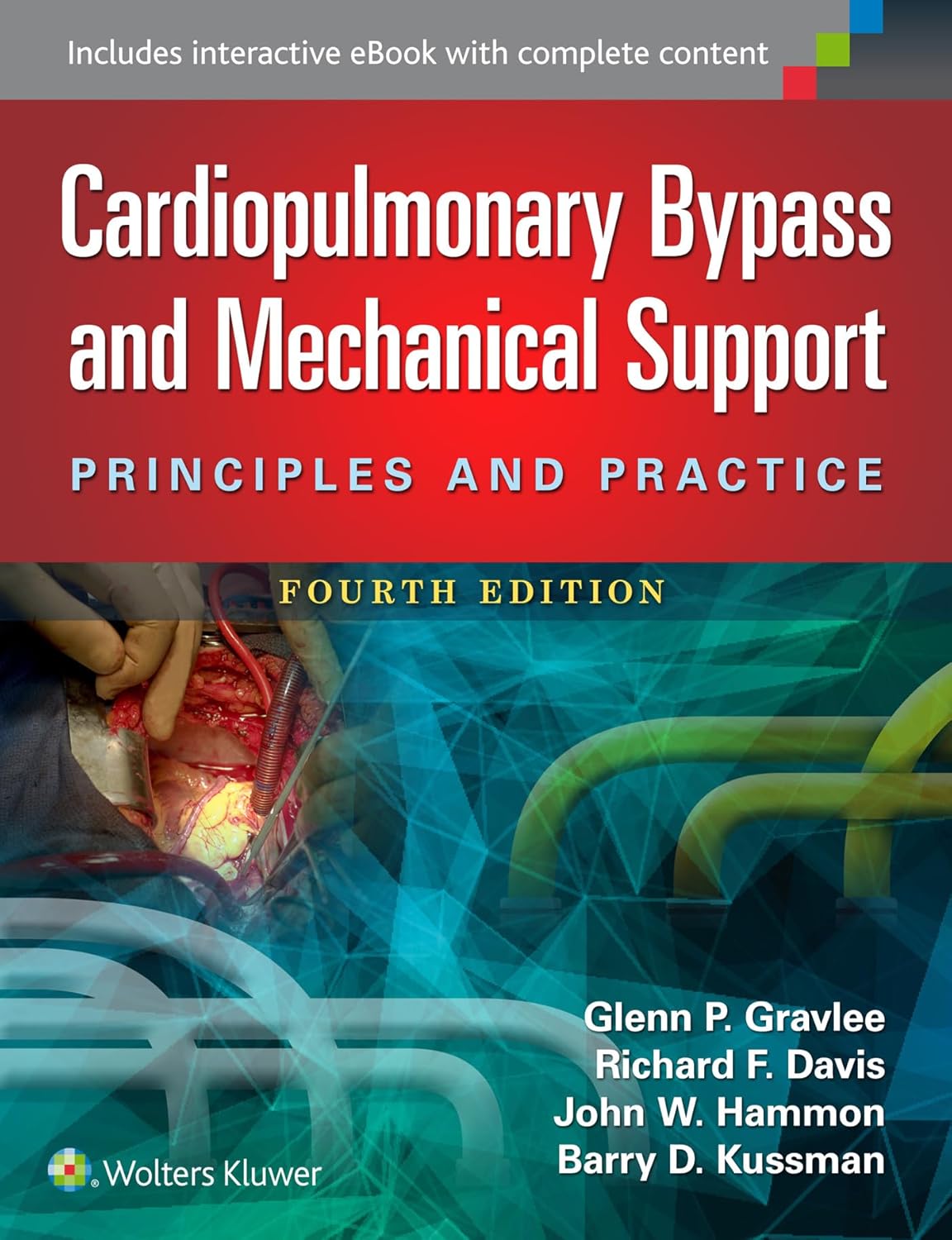 Cardiopulmonary Bypass and Mechanical Support: Principles and Practice ...