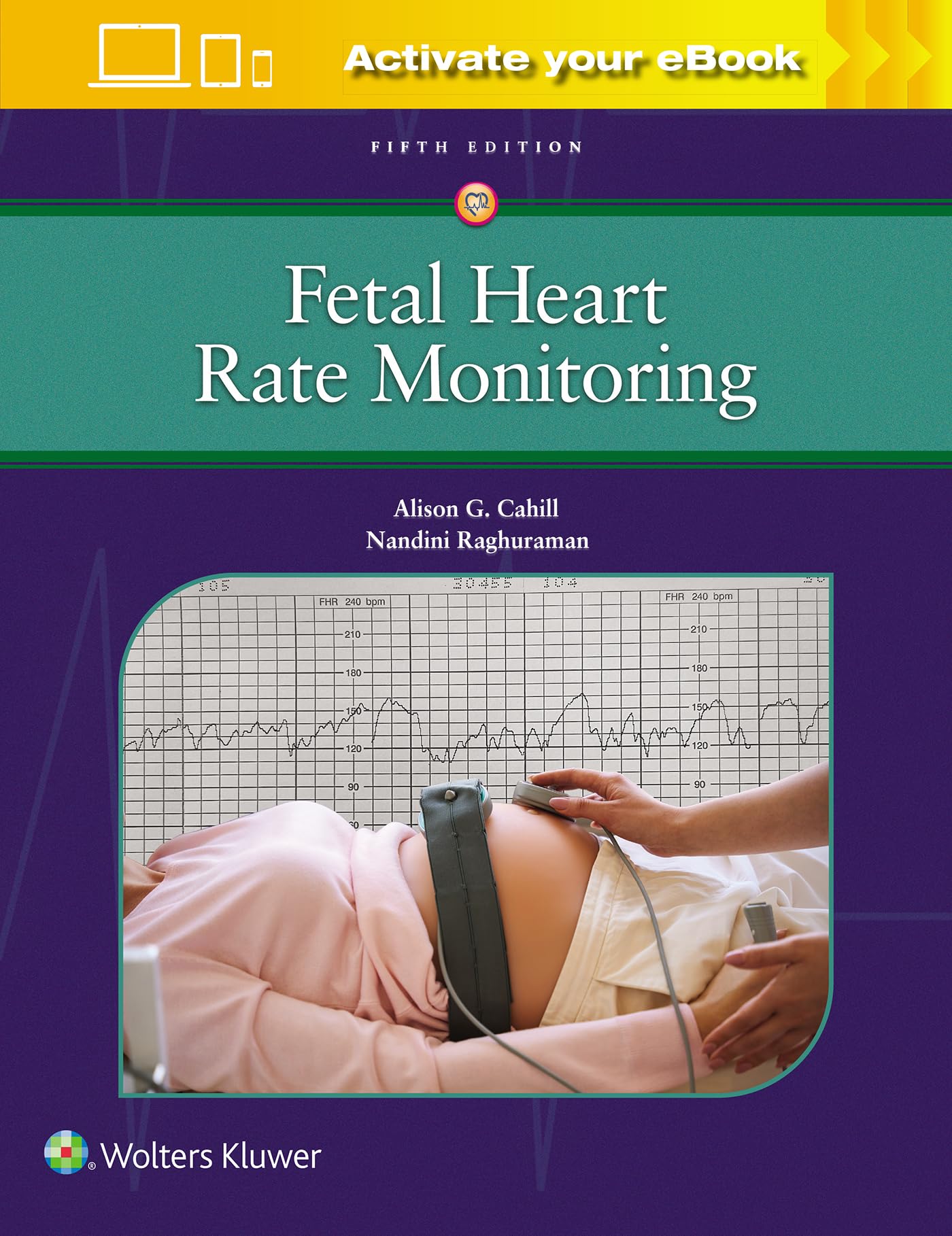 Fetal Heart Rate Monitoring: 9781975216184: Medicine & Health Science ...