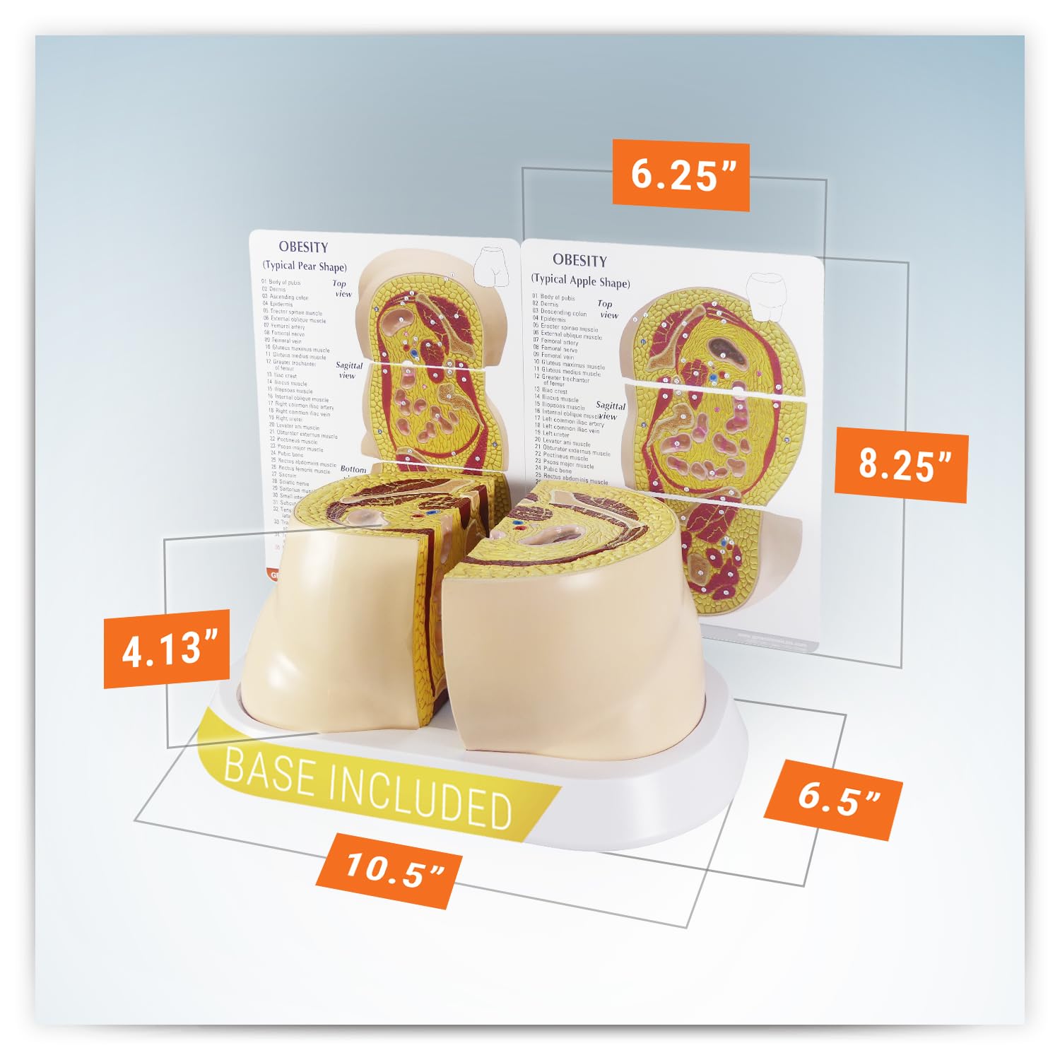 Snapklik.com : Obesity Model, Replica Of The Hip Area Depicting Effects ...