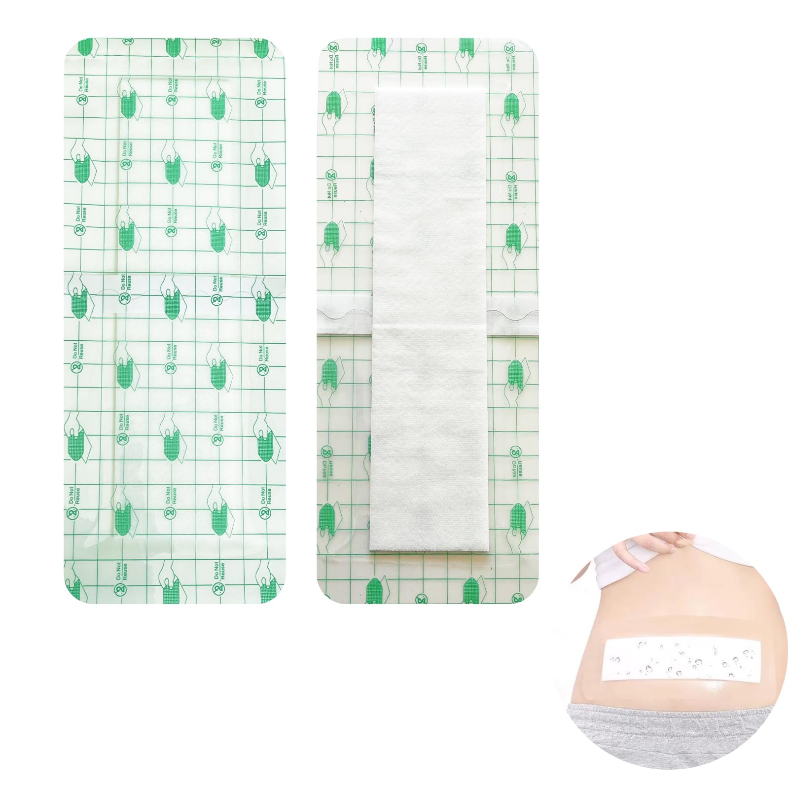 Incision Island Dressing,Section Adhesive Island Wound Dressings Pads ...