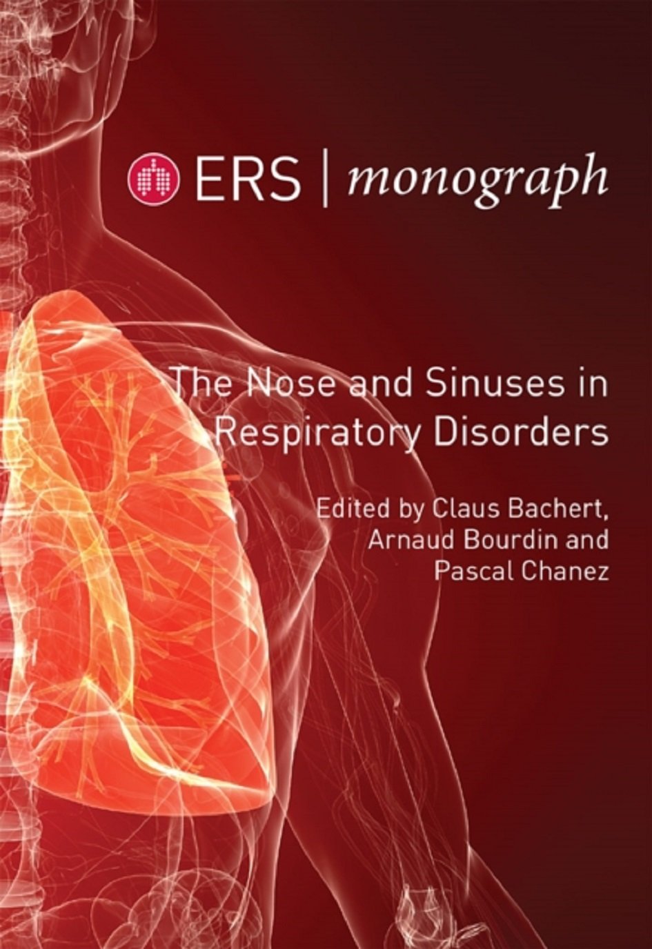 Nose and Sinuses in Respiratory Disorders (ERS Monograph) - Kindle ...