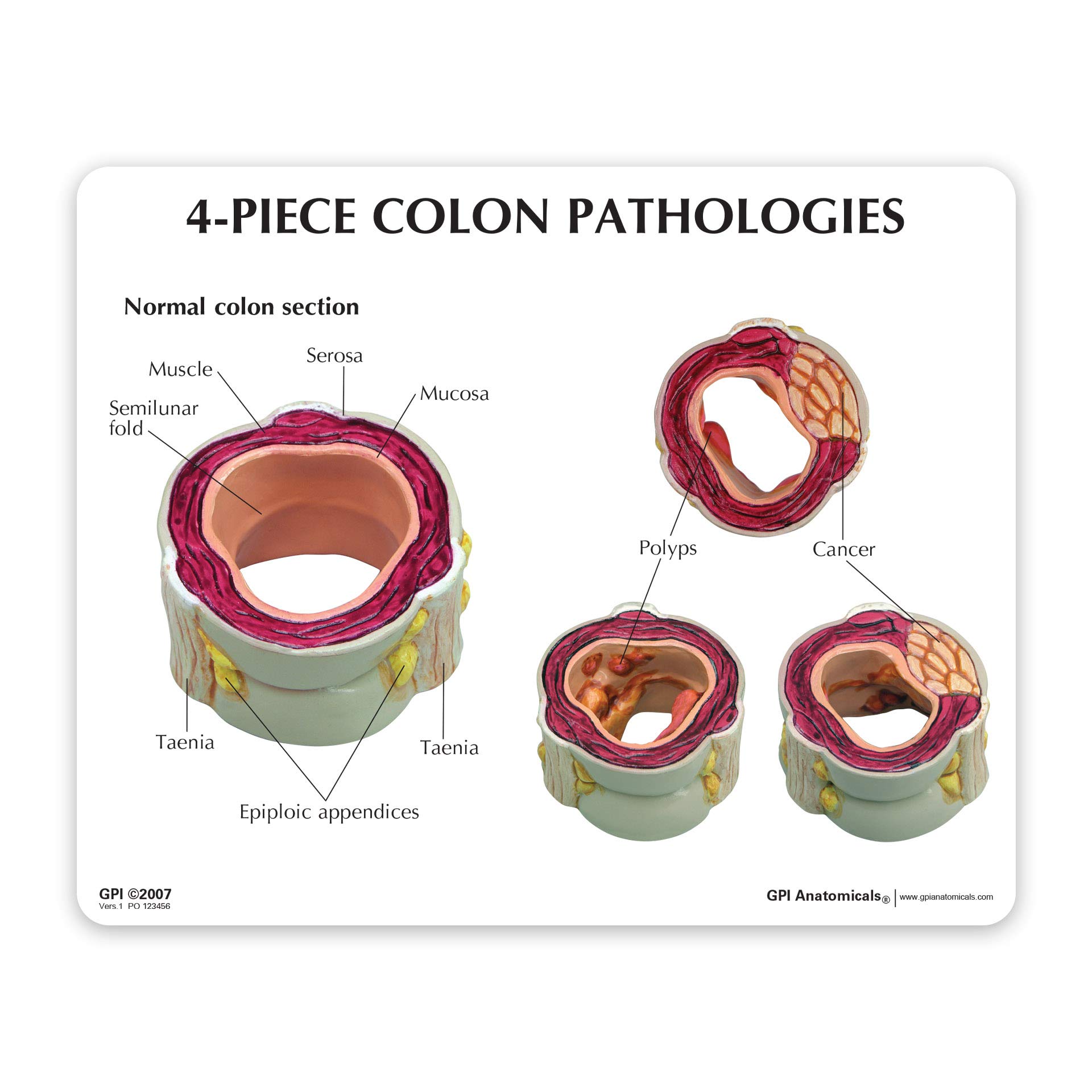 Snapklik.com : GPI Anatomicals - 4-Piece Colon Model, Replica Of A Colon