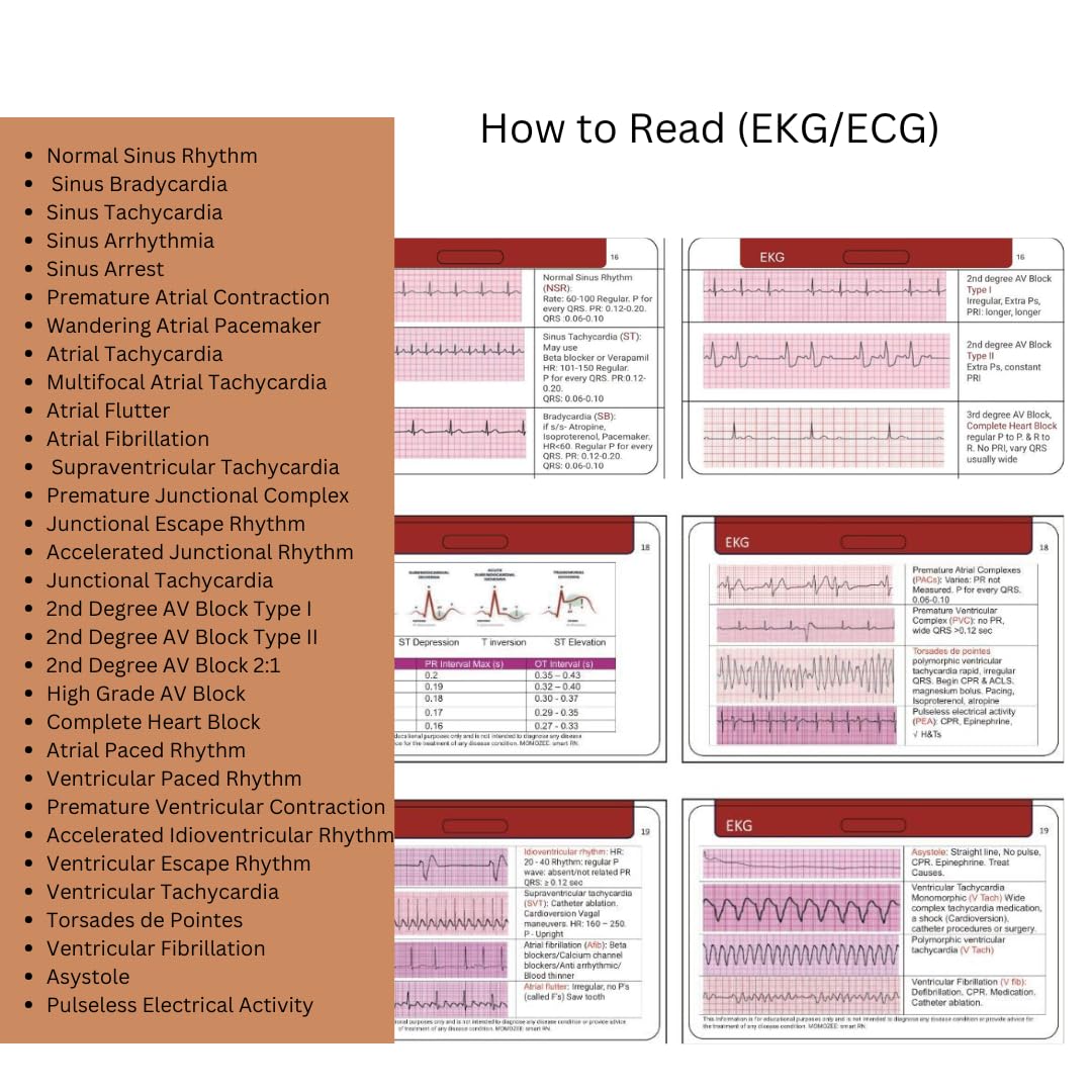 Snapklik.com : EKG Badge Card EKG Badge Buddy Nursing Reference ECG ...
