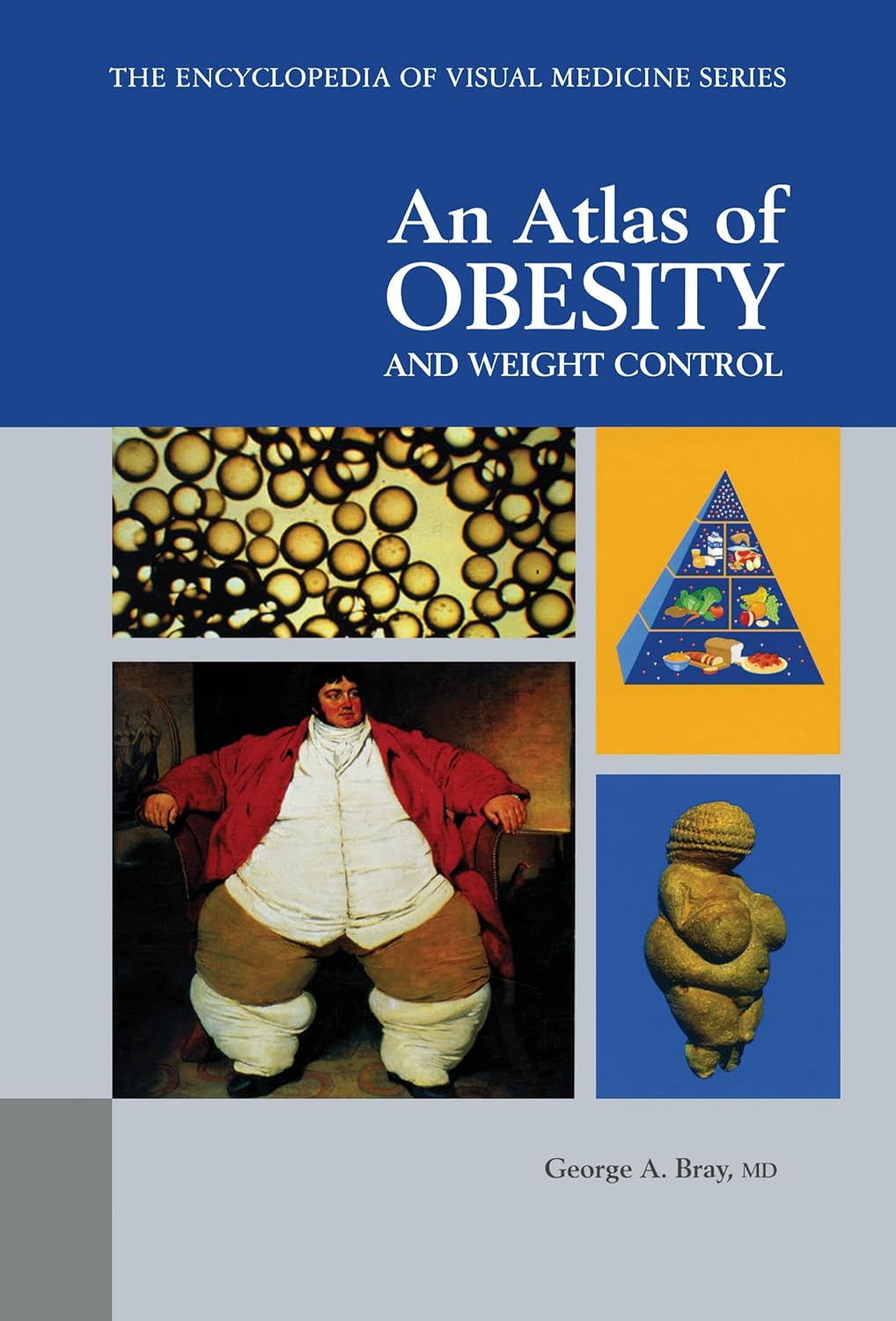 An Atlas of Obesity and Weight Control (Encyclopedia of Visual Medicine ...