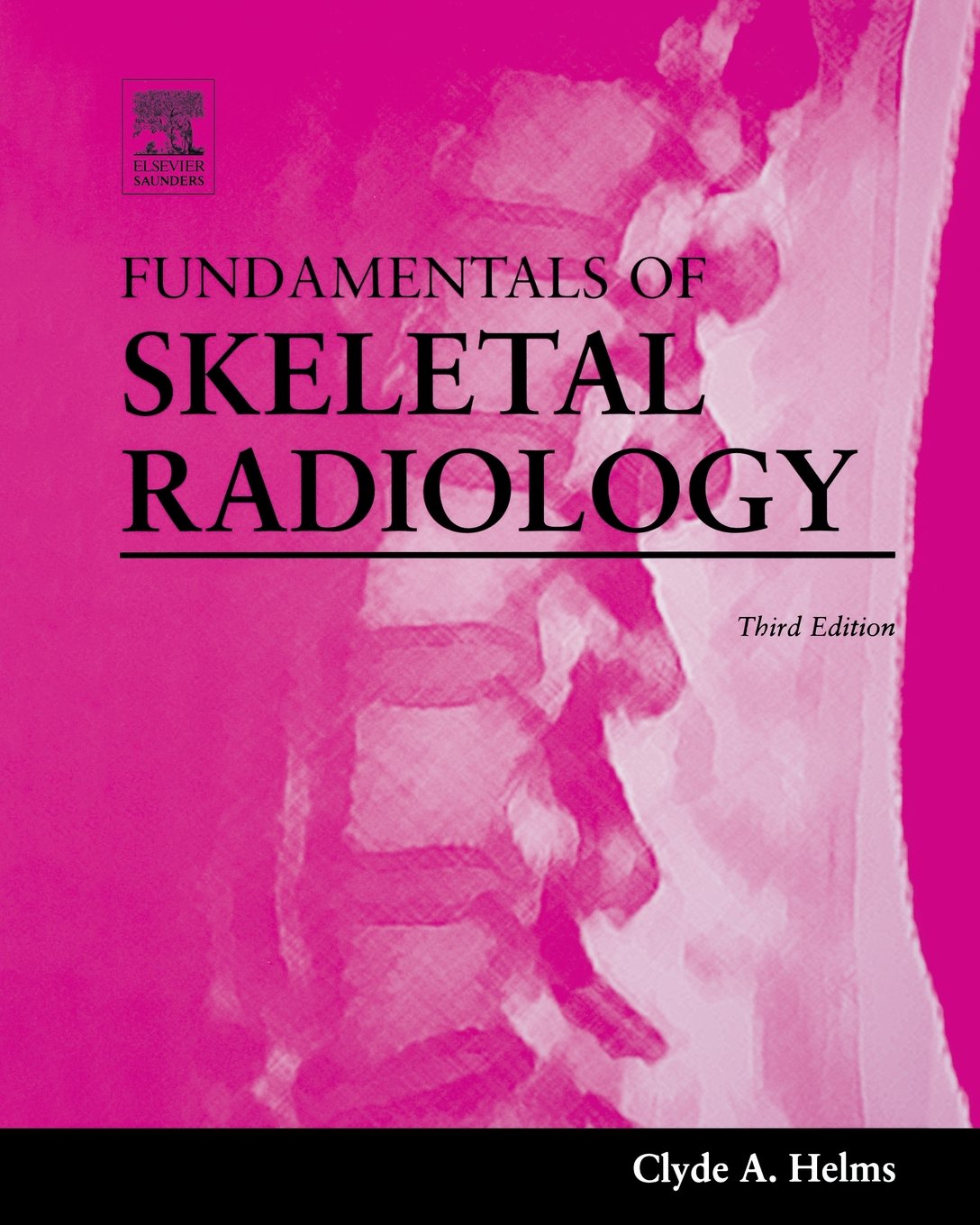 Fund of Skeletal Radiology 3e (Fundamentals of Radiology) : Helms ...