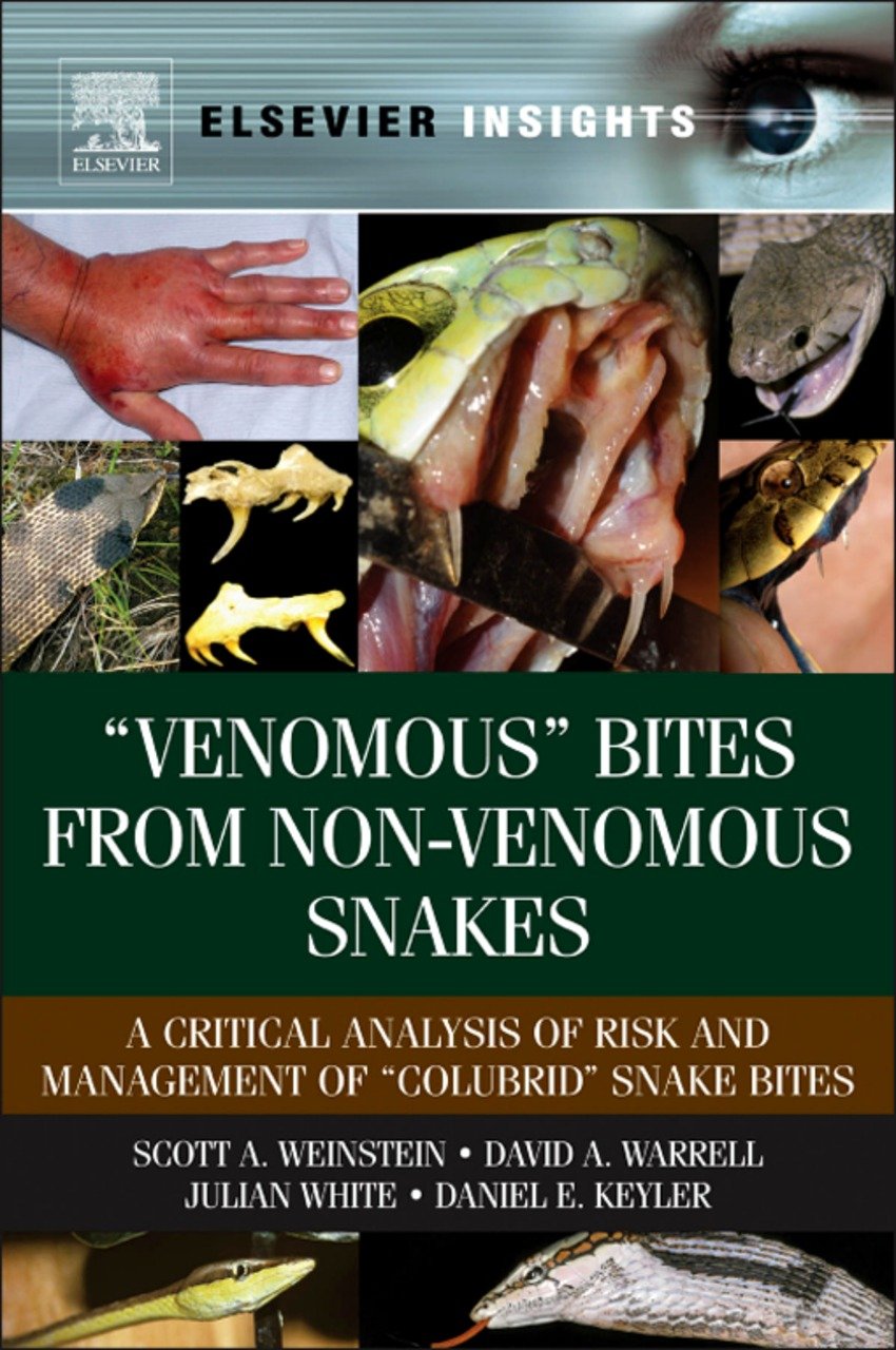 Amazon.com: “Venomous Bites from Non-Venomous Snakes: A Critical ...