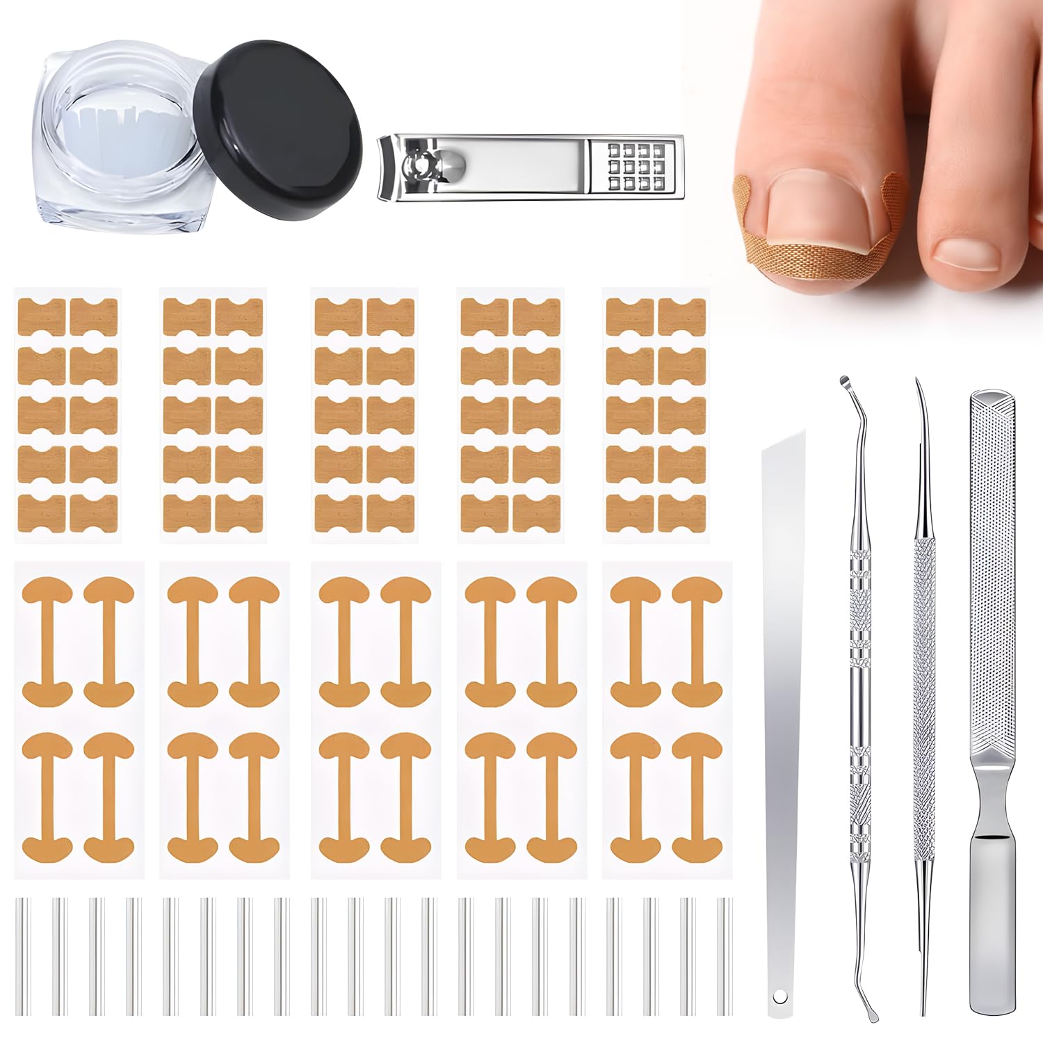 Amazon.com: Ingrown Toenail Corrector Set with Correction Strips ...