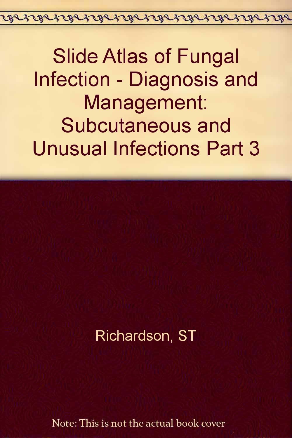 Buy Subcutaneous and Unusual Infections (Part 3) (Slide Atlas of Fungal ...