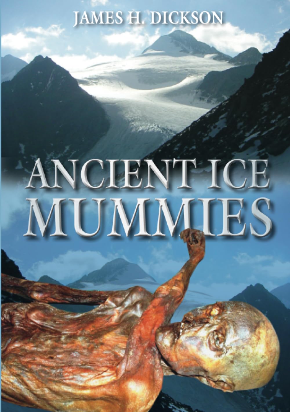 Ancient Ice Mummies: Dickson, James H.: 9780752459356: Amazon.com: Books