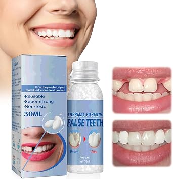 Tooth Repair Granules, Temporary Filler for Missing Teeth, Temporary ...