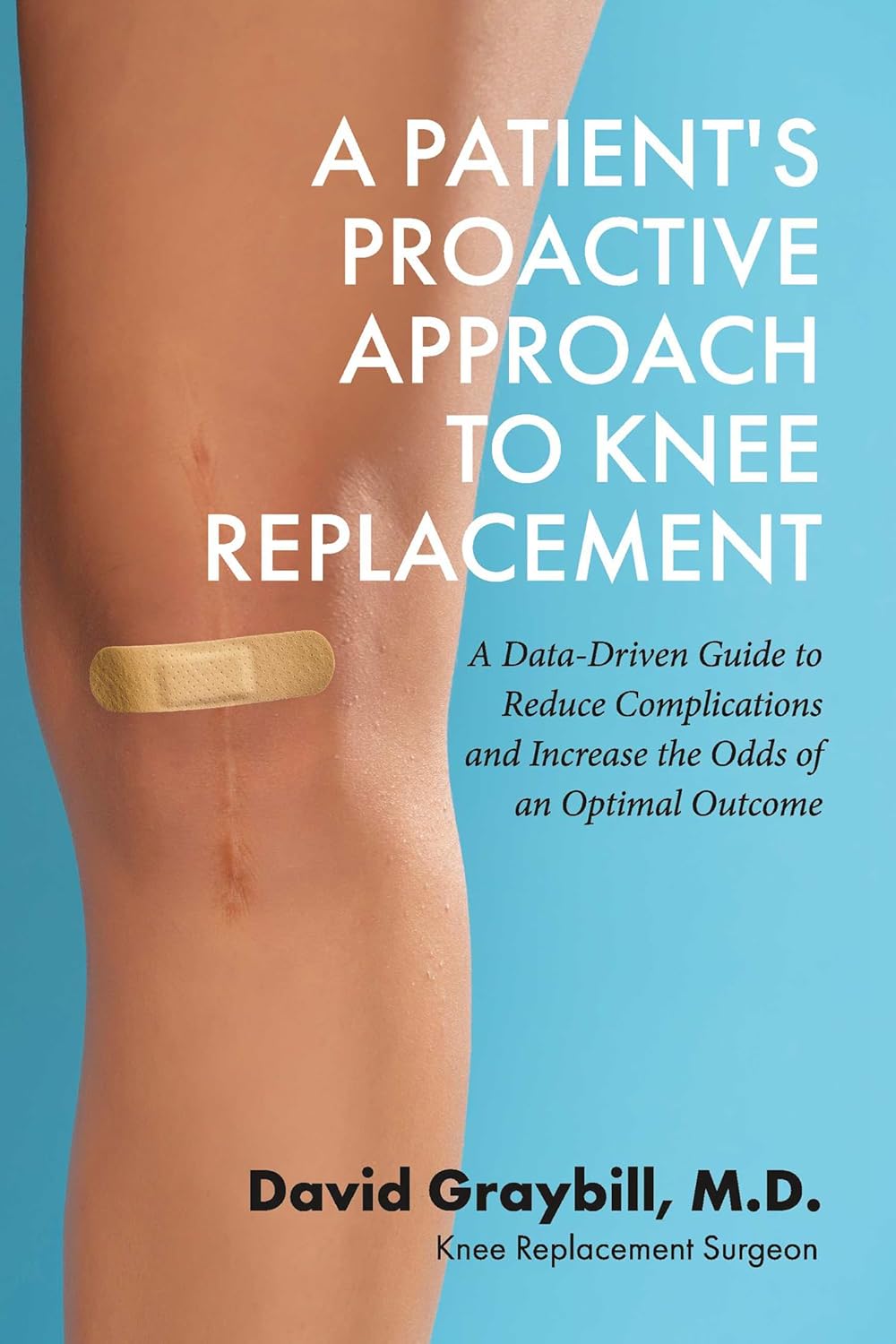 Amazon.com: A Patient's Proactive Approach to Knee Replacement: A Data ...