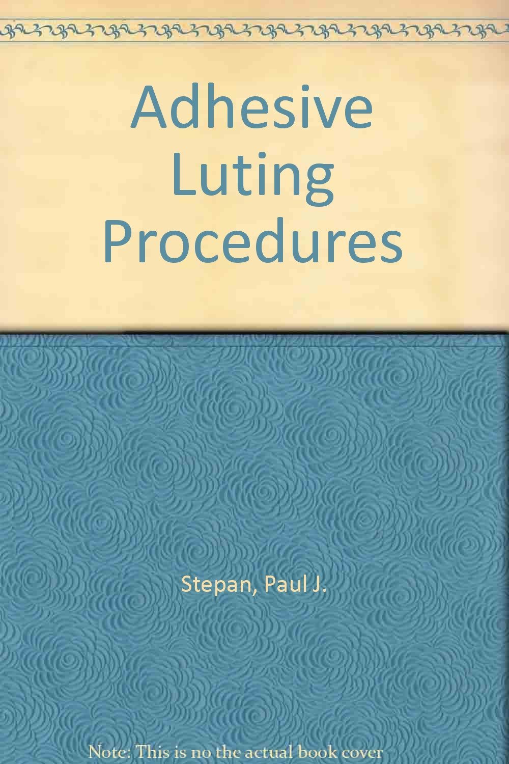 Amazon | Adhesive Luting Procedures | Stepan, Paul J. | Dentistry